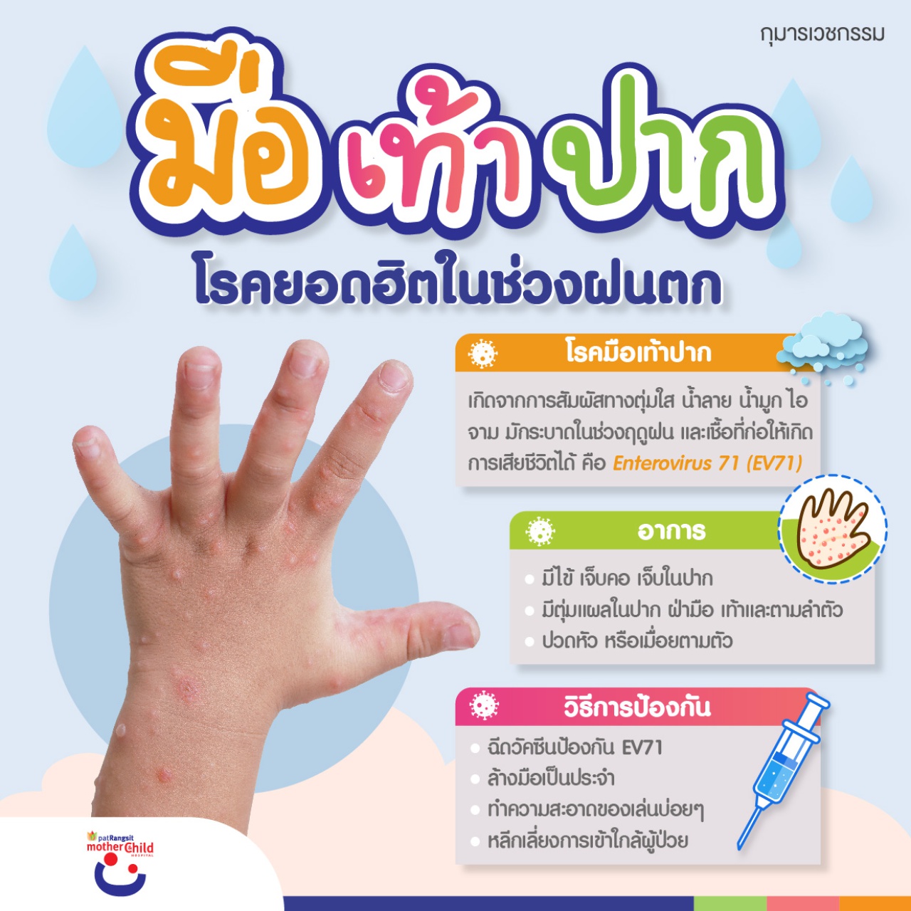 โรคมือเท้าปาก โรคยอดฮิตในเด็ก - โรงพยาบาลแพทย์รังสิต